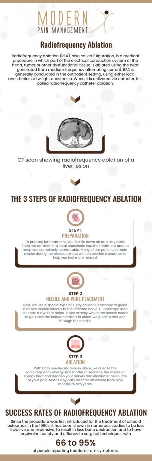 Radiofrequency Ablation Treatment for Pain | Dr. George Atallah